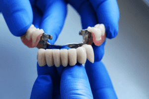 Dental Bridges Virginia Beach | Mill Dam Dental Care